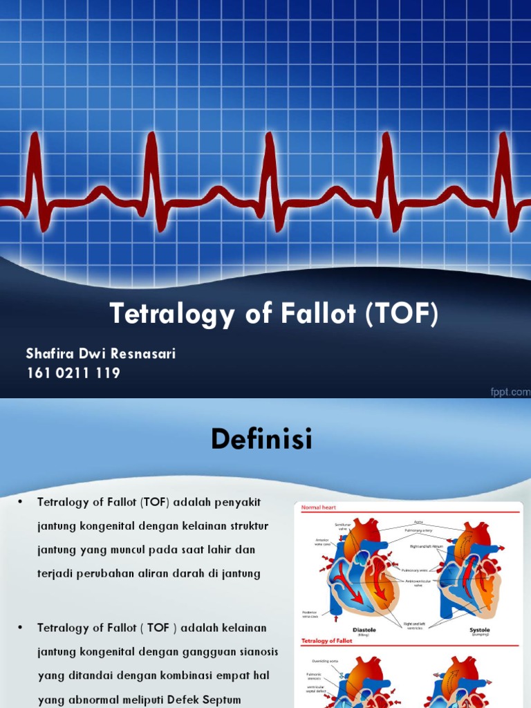 Tetralogy of Falot | PDF | Sains & Matematika