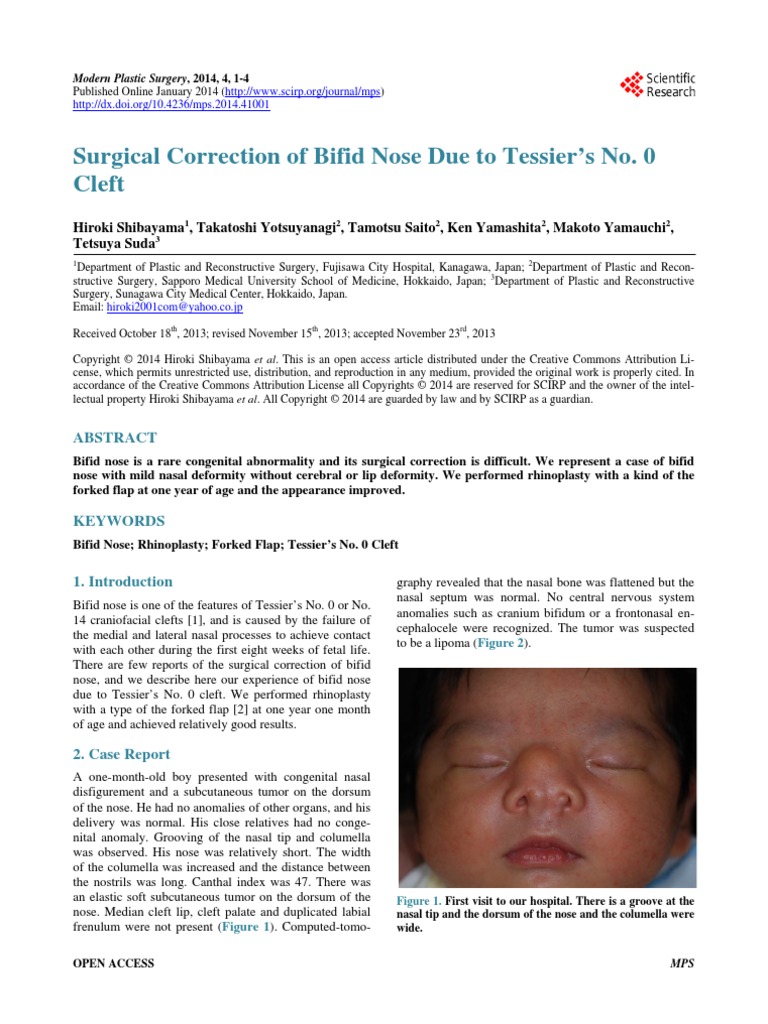 Surgical Correction of Bifid Nose Due To Tessier's No. 0 Cleft PDF ...