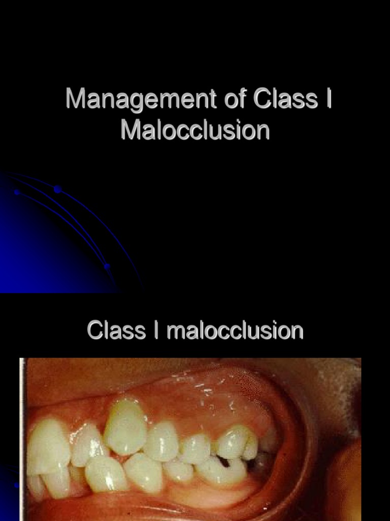 Class I Malocclusion Treatment Guide | PDF | Face | Animal Anatomy
