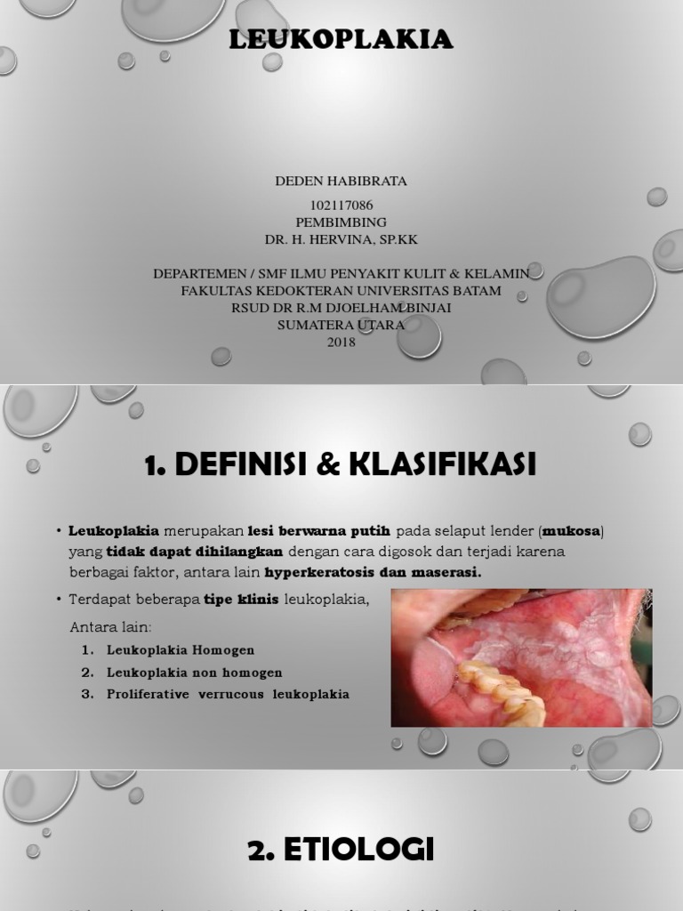 Leukoplakia | PDF