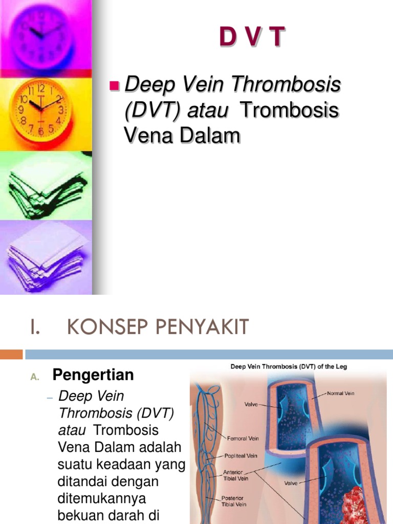 Deep Vein Thrombosis (DVT) Atau Trombosis: Vena Dalam | PDF