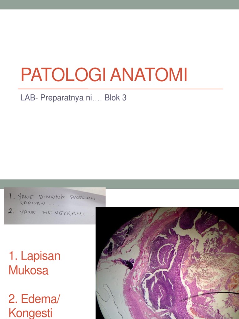 Patologi Anatomi Blok 3 | PDF
