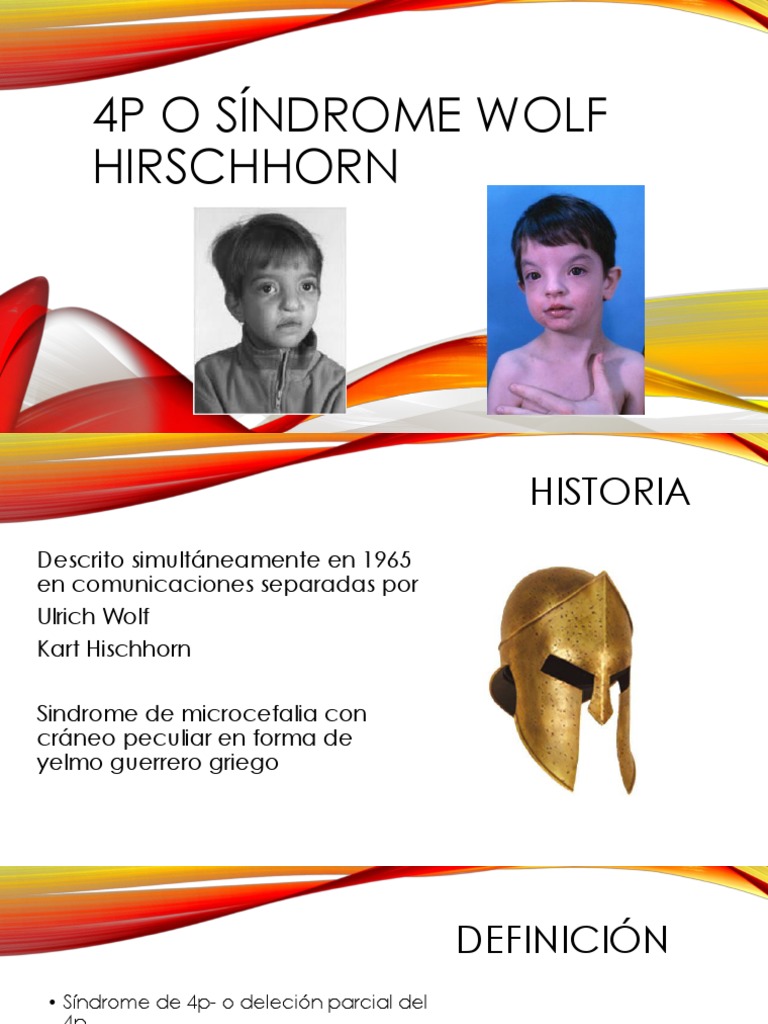 4p o SÍndrome Wolf Hirschhorn | PDF
