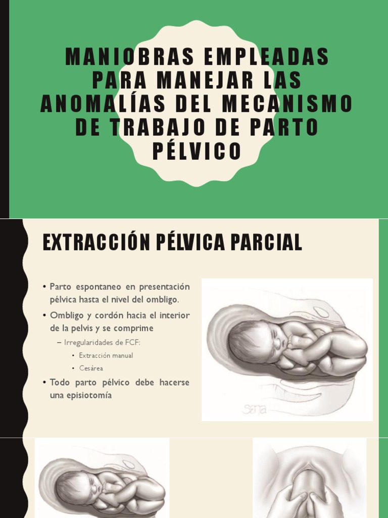 Maniobras para Parto Pélvico y Cesárea | PDF | Pelvis | Parto