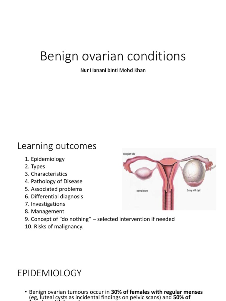 Benign Ovarian Conditions | Ovarian Cancer | Ovary