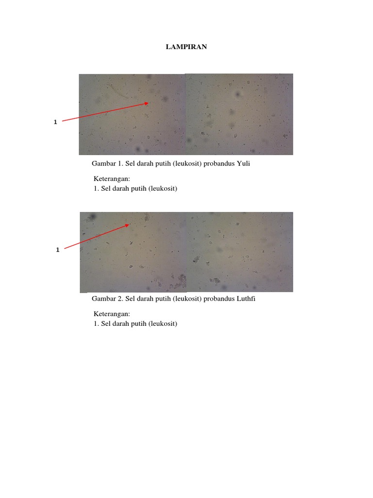 Gambar 1. Sel Darah Putih (Leukosit) Probandus Yuli Keterangan: 1. Sel ...