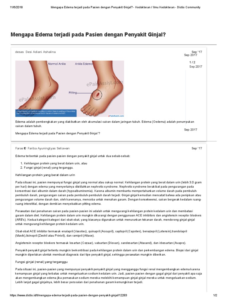 Mengapa Edema Terjadi Pada Pasien Dengan Penyakit Ginjal - Kedokteran ...