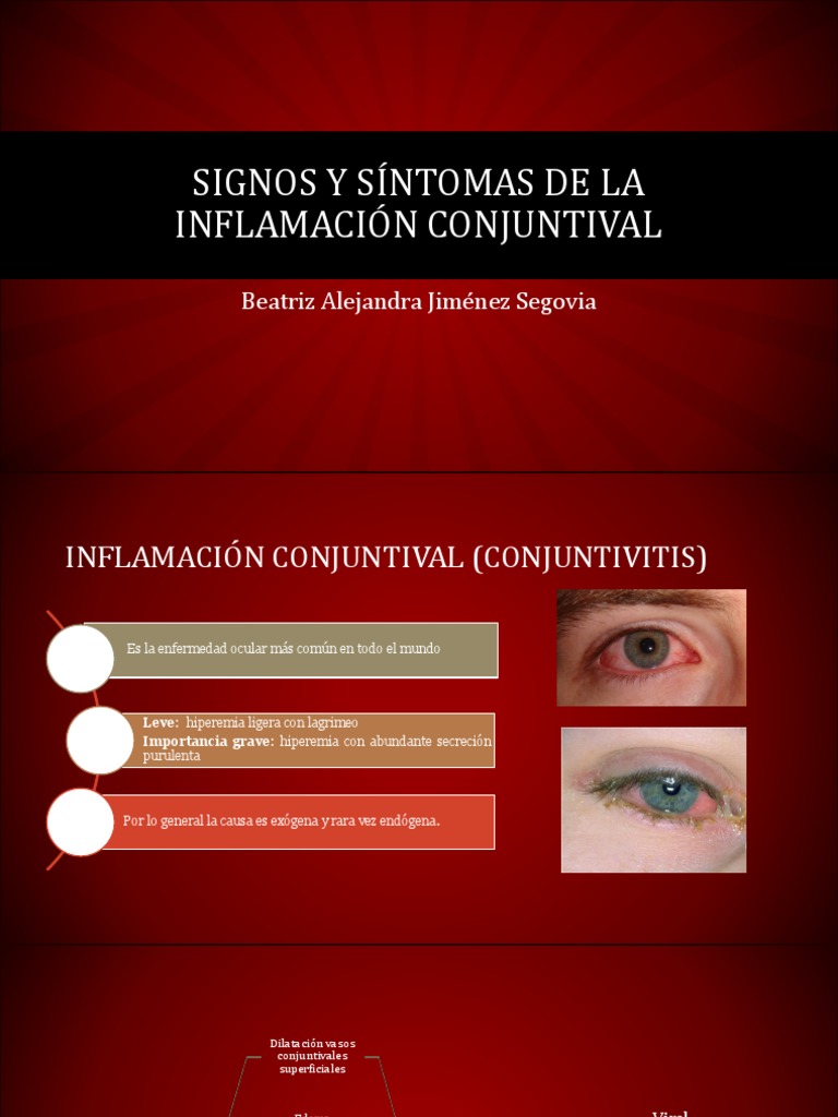 Signos y Síntomas de La Inflamación Conjuntival | Descargar gratis PDF ...