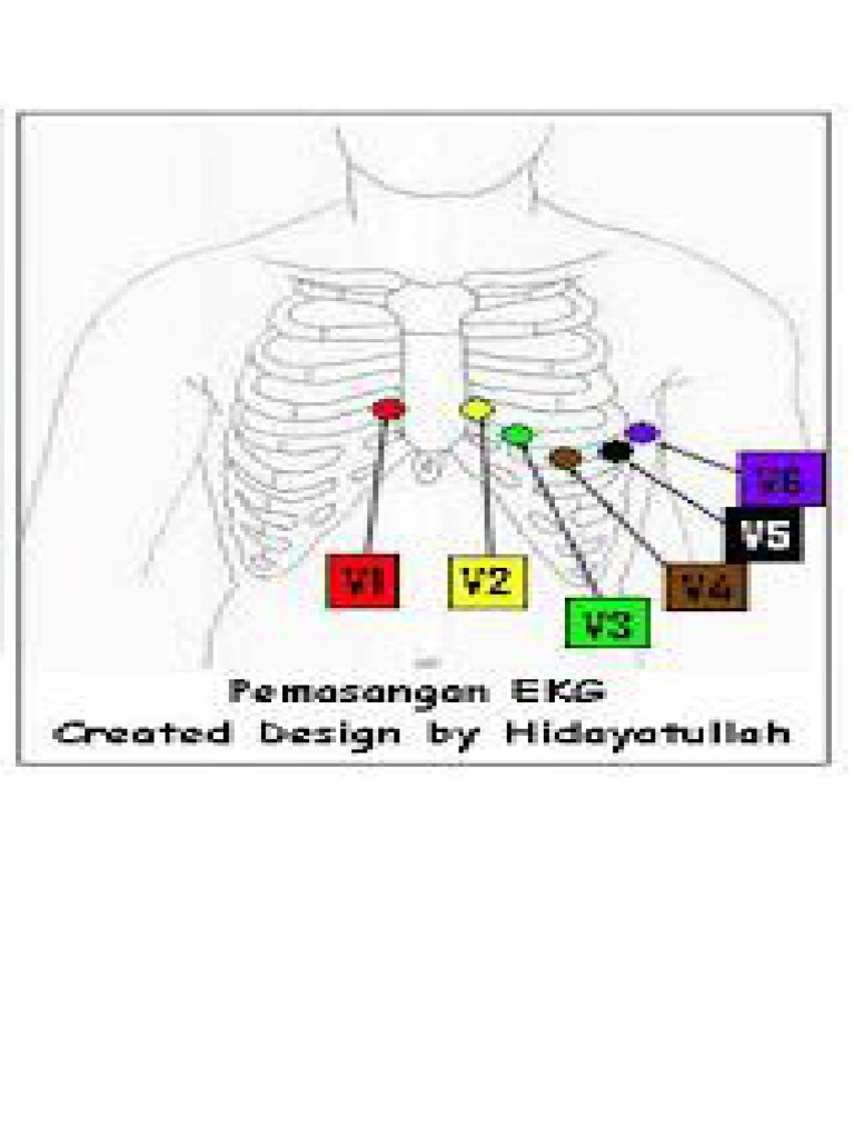 Pemasangan Ekg | PDF