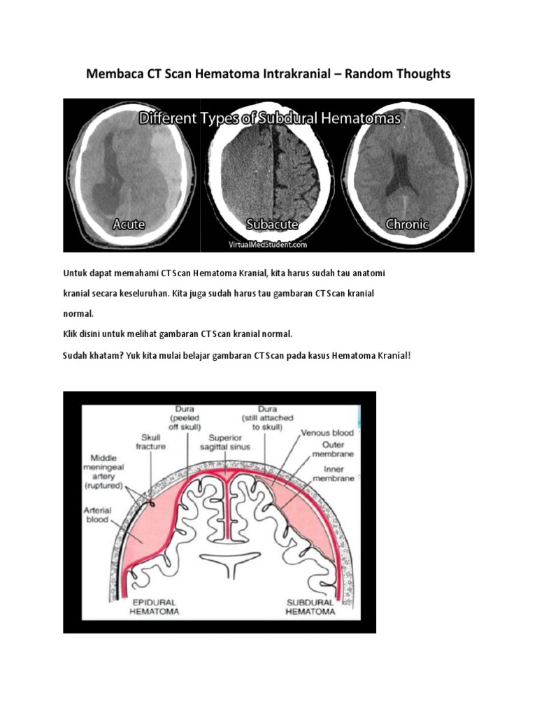 Membaca CT Scan Hematoma Intrakranial | PDF