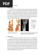 Fraktur Antebrachii: Diagnosis dan Pengobatan | PDF