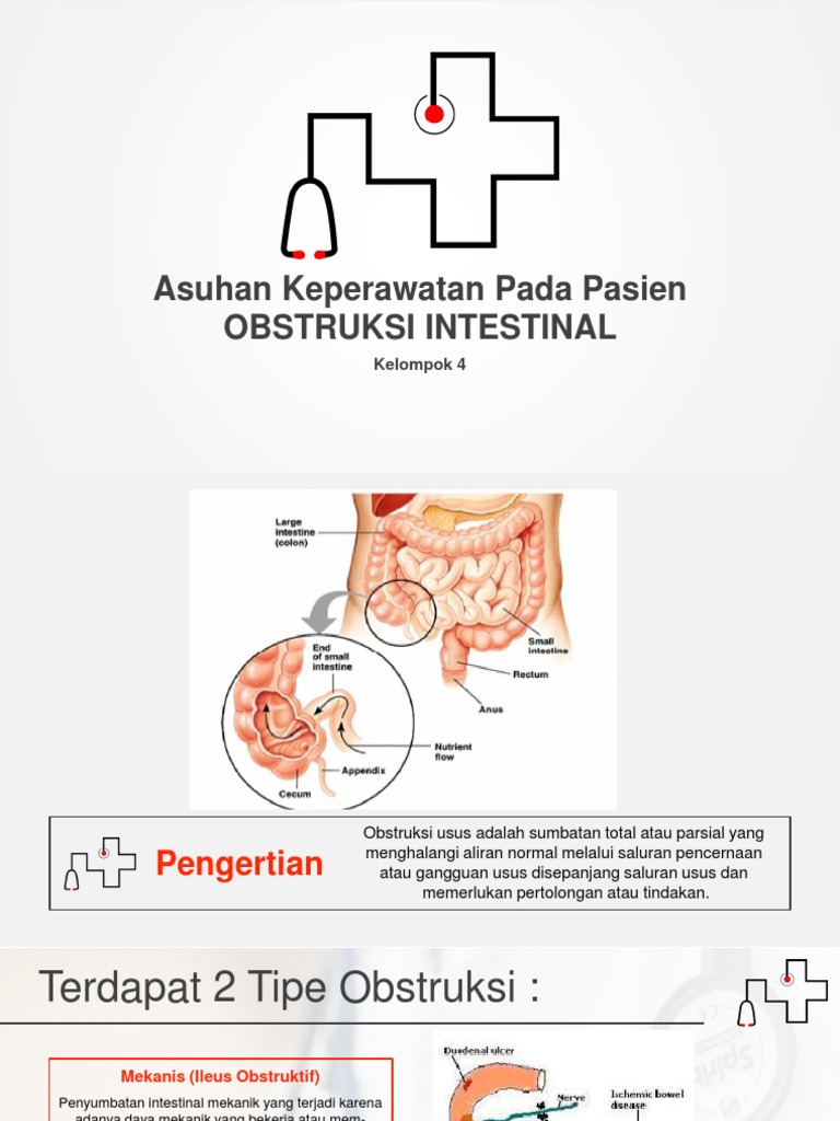 T11 - Obstruksi Usus Ileus | PDF