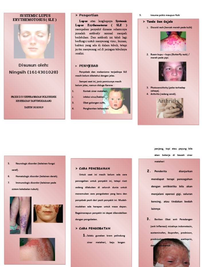 Leaflet Lupus Ningsih | PDF