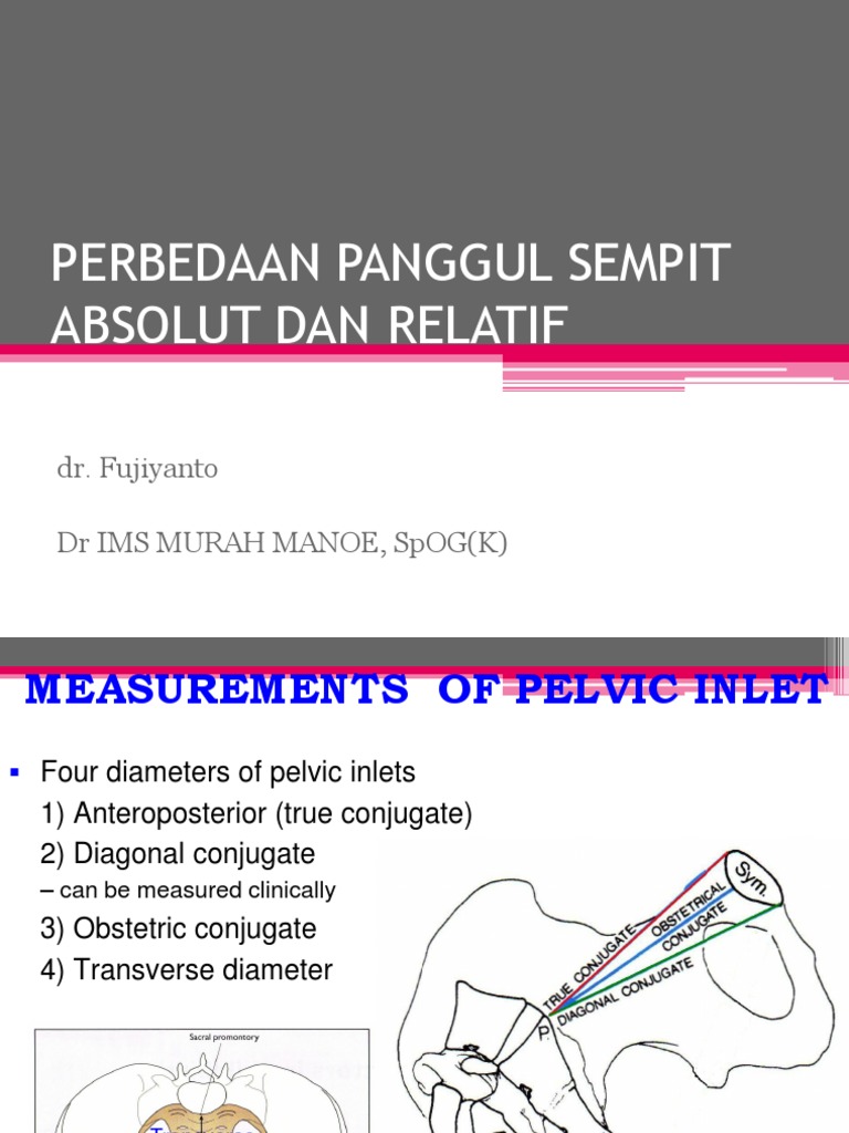 Panggul Sempit | PDF | Pelvis | Childbirth