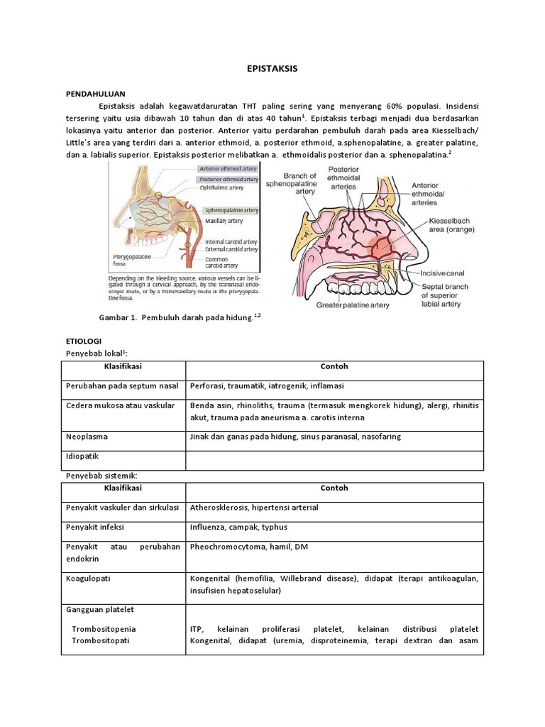 Epistaksis | PDF