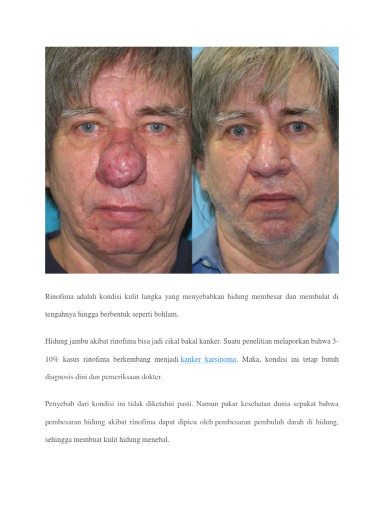 Rinofima | PDF | Sains & Matematika