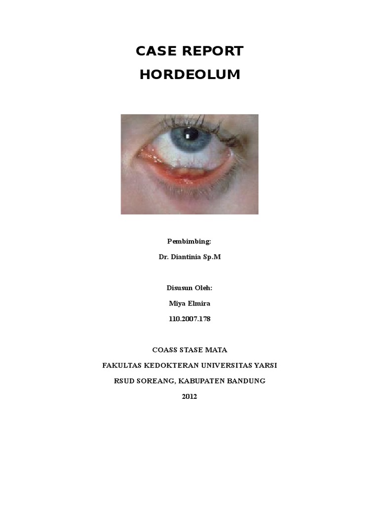 Case Report Hordeolum | PDF