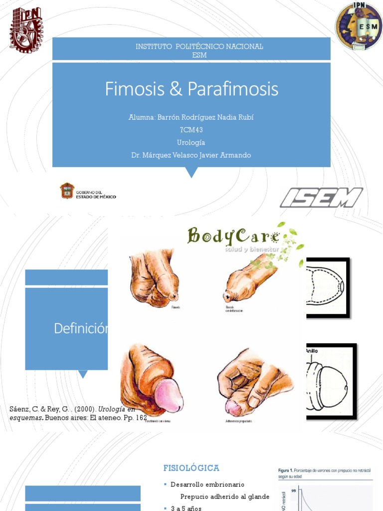 Fimosis Parafimosis | PDF | Medicina | Pene