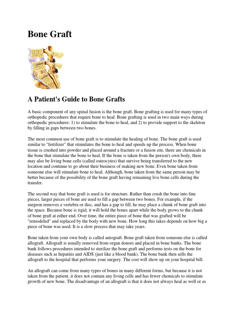 Bone Graft: A Patient's Guide To Bone Grafts | PDF | Bone | Surgery