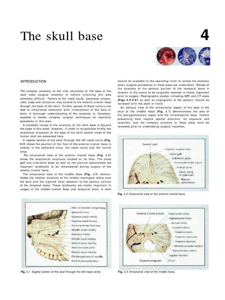 Skull Base Surgery Essentials | PDF | Skull | Carcinoma
