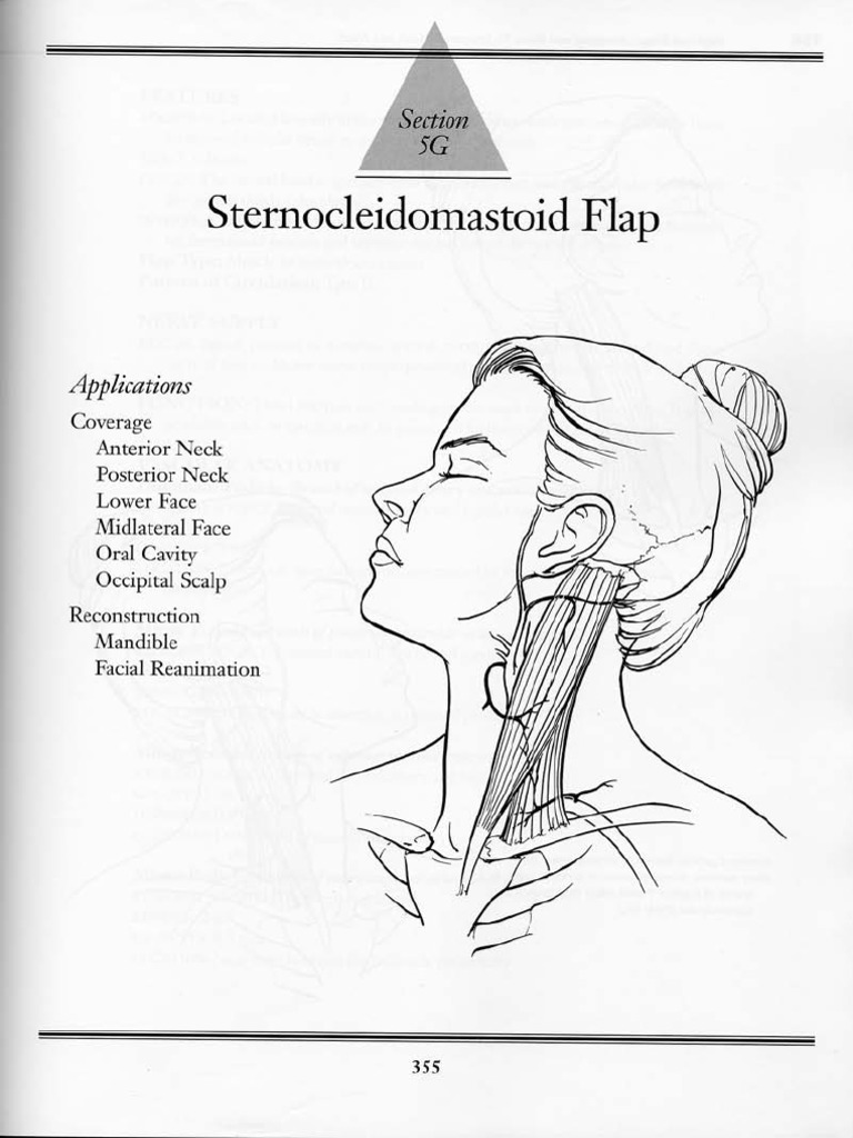 5G - Sternocleidomastoid Flap