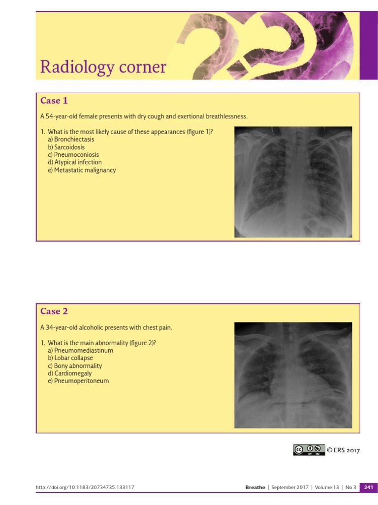 Radiology Corner: Case 1 | PDF | Lung | Medical Specialties