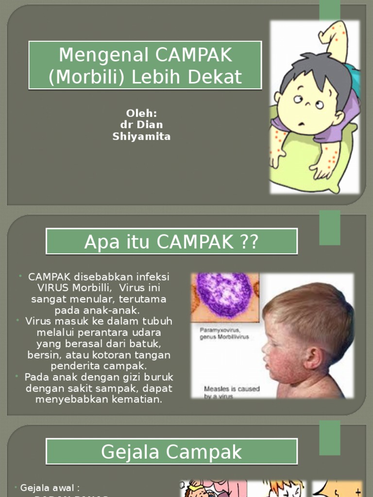 Penyuluhan Campak | PDF