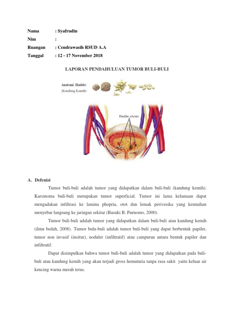Laporan Pendahuluan Tumor Buli-Buli | PDF | Sains & Matematika