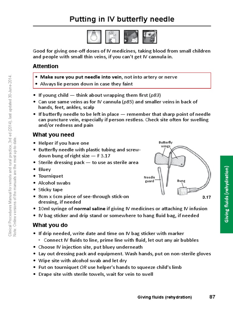 Putting in IV Butterfly Needle | PDF | Intravenous Therapy | Medical ...