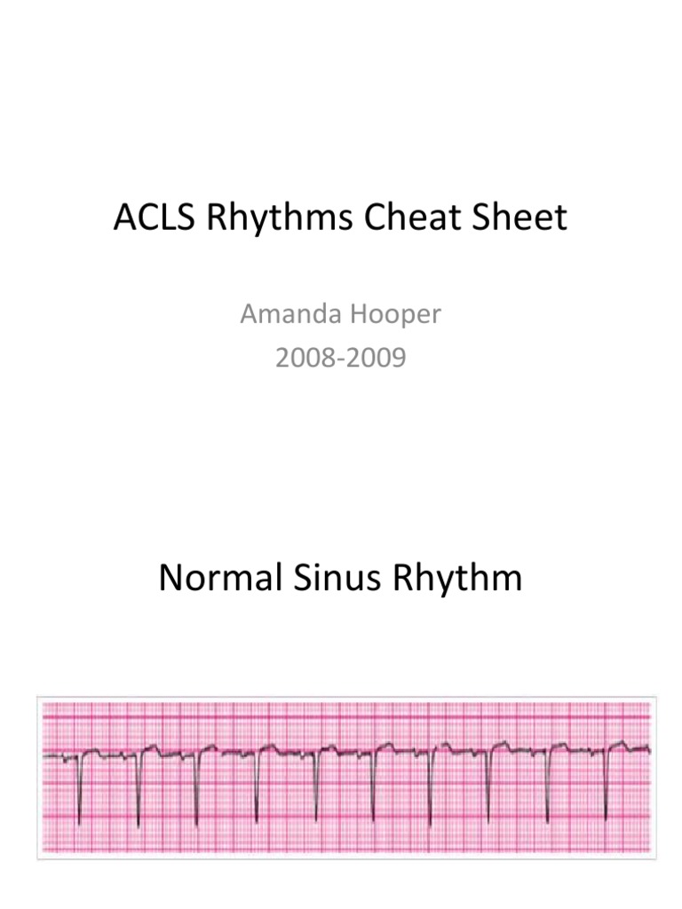 ACLS Rhythms Cheat Sheet | PDF