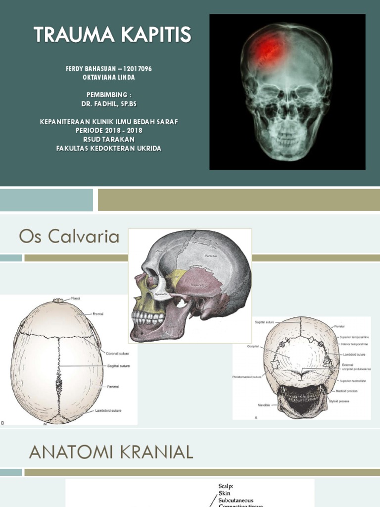 Anatomi Dan Trauma Kapitis | PDF