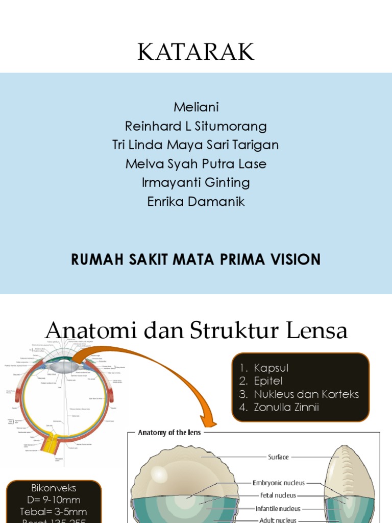 Katarak | PDF