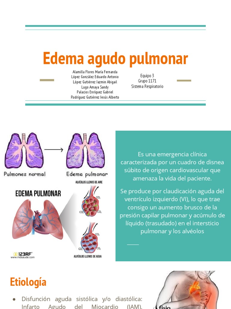 Cardio | PDF | Insuficiencia cardíaca | Edema