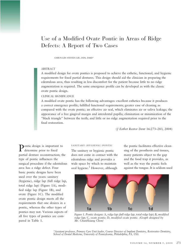 Ponticos Ovoides | Download Free PDF | Dentures | Mouth