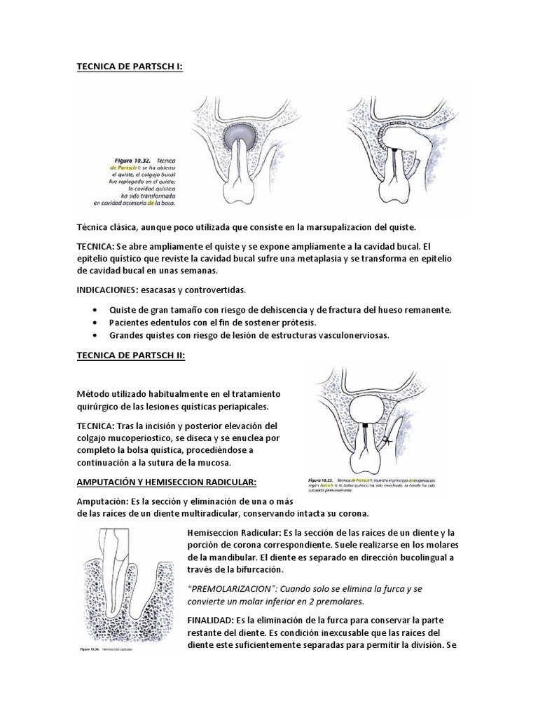 Tecnica de Partsch - Expo | PDF | Medicina | Especialidades Medicas