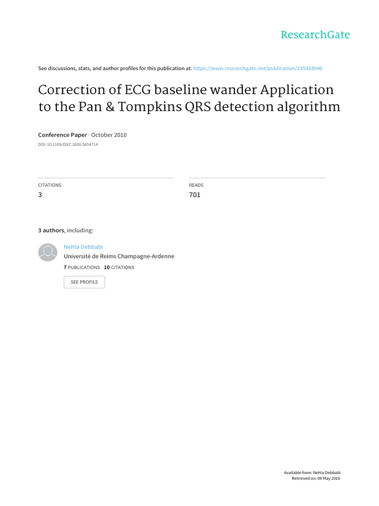 Correction of ECG Baseline Wander Application To The Pan & Tompkins QRS ...