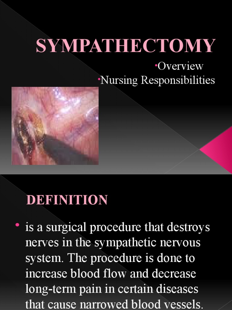 SYMPATHECTOMY | PDF | Self-Improvement