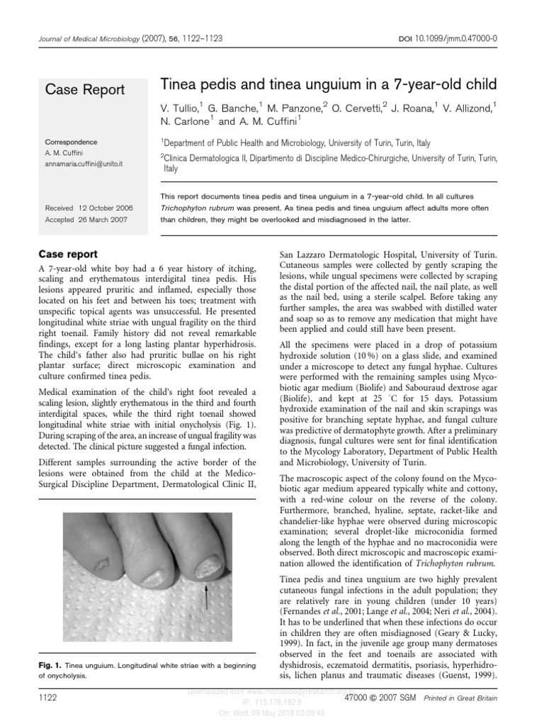 Tinea Pedis and Tinea Unguium in A 7-Year-Old Child: Case Report | PDF ...