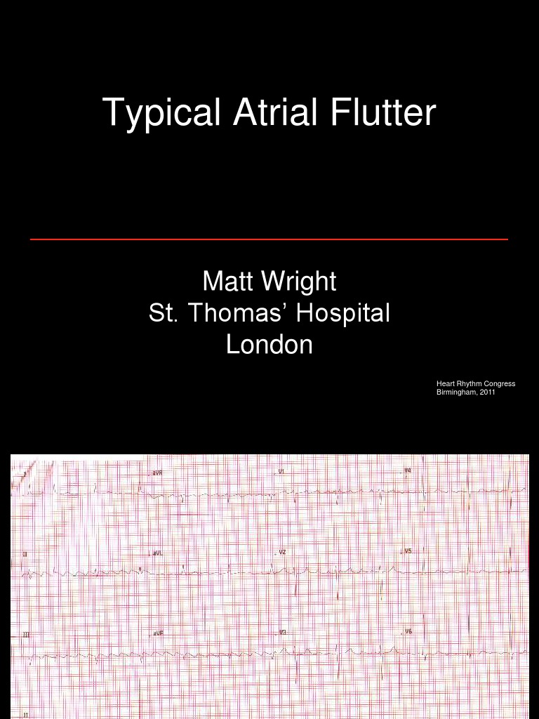 Atrial Flutter: Diagnosis and Ablation | PDF | Cardiology | Heart