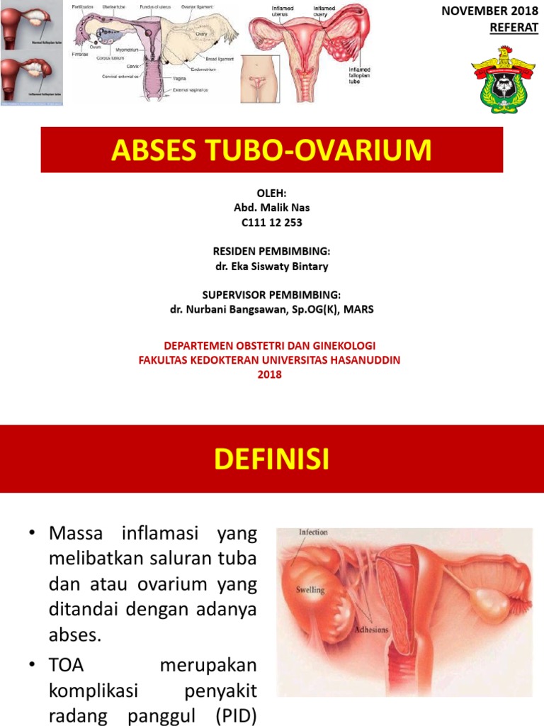 Abses Tubo-Ovarium | PDF