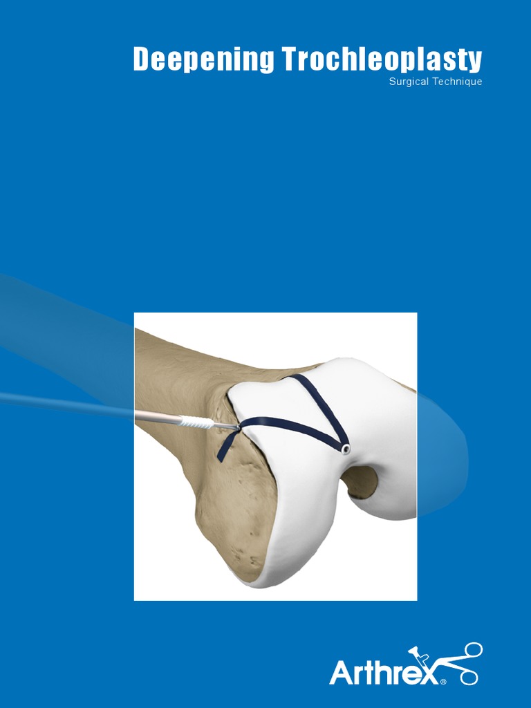 Deepening Trochleoplasty: Surgical Technique | PDF | Knee ...