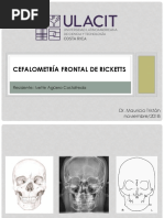 Análisis de Wala | PDF | Odontología | Ortodoncia