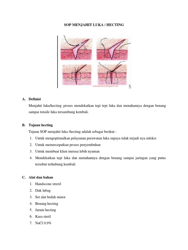 Sop Menjahit Luka / Hecting | PDF