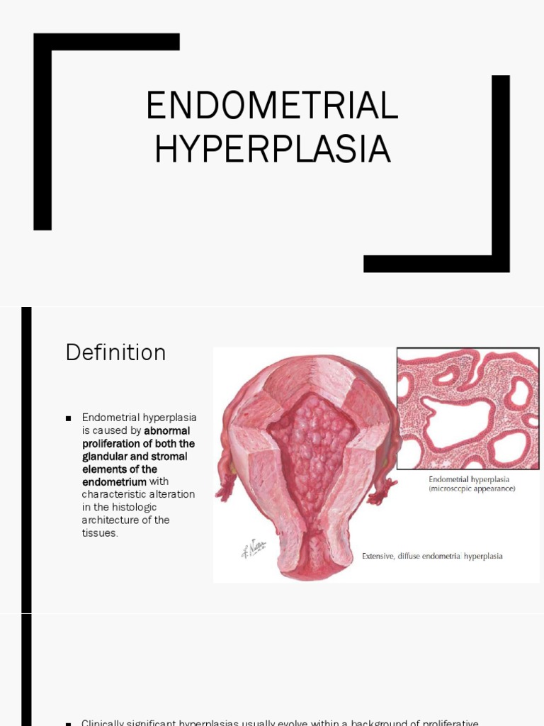 Endometrial Hyperplasia | PDF | Gynaecology | Women's Health