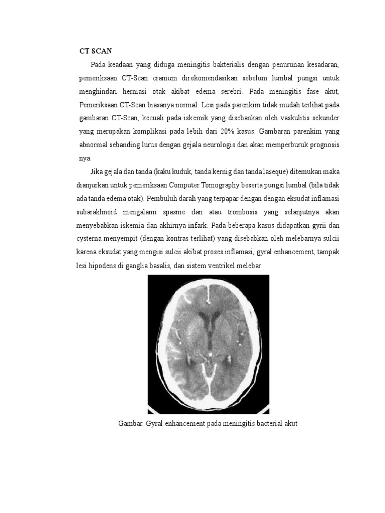 CT SCAN Meningitis | PDF