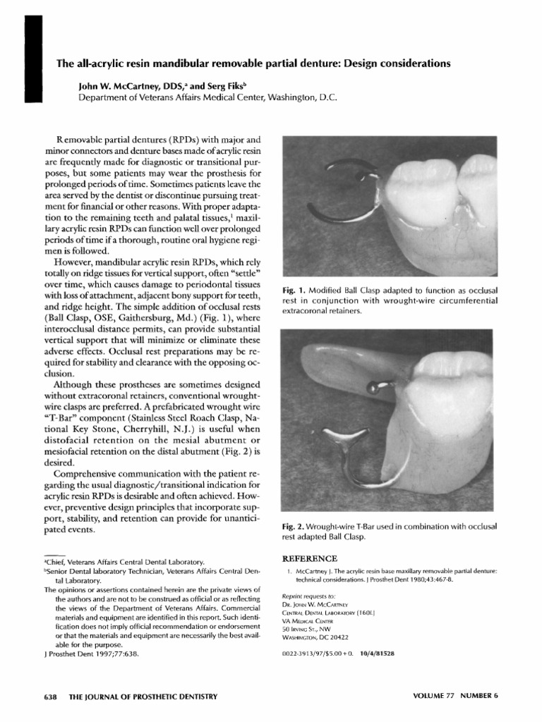 The All Acrylic Resin Mandibular Removable Partial Denture Design ...