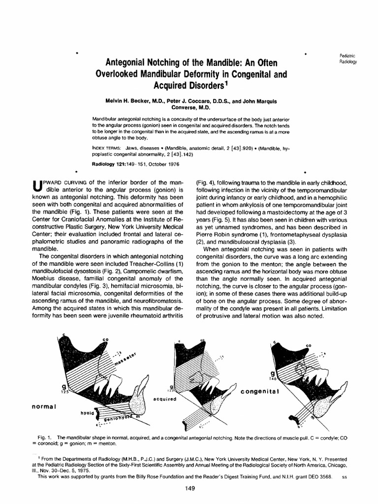 Antegonial Notch | Download Free PDF | Musculoskeletal System | Medicine