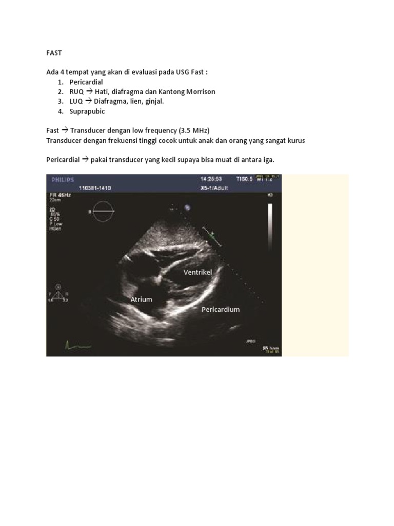 Usg Fast | PDF