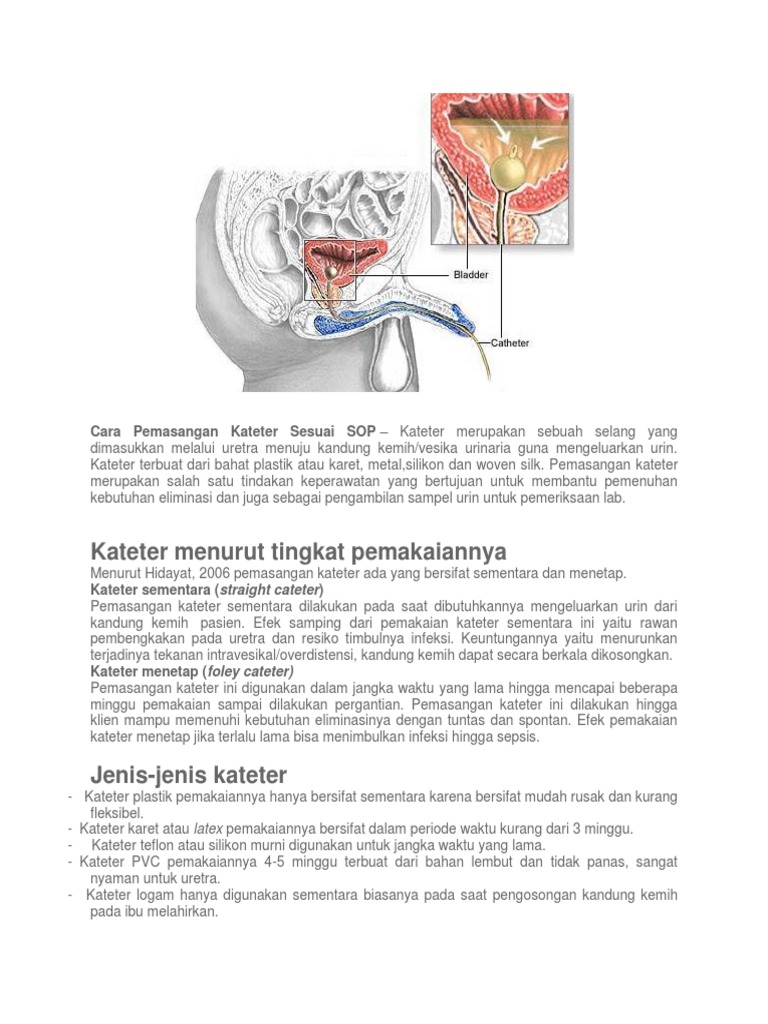 Cara Pemasangan Kateter Sesuai SOP | PDF