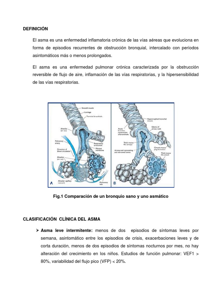 Informe de Asma | PDF | Asma | Inflamación